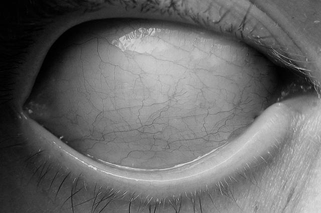 Dead Eye | PhotoAtelier Blog